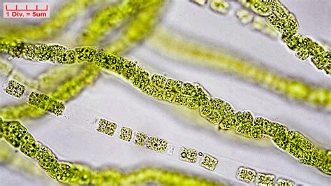 Cyanobacteria Unknown 1007 