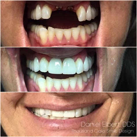 Daniel Elbert Dds Home Facebook