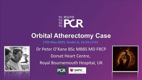 Orbital Atherectomy A Versatile Tool In Managing Complex Scenarios Of Vessel Calcification