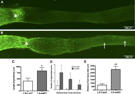 Overexpression Of Sac Promotes Axonal Regeneration In Vivo The Right