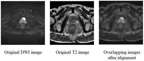 Algorithms Free Full Text Semi Automatic Multiparametric Mr Imaging