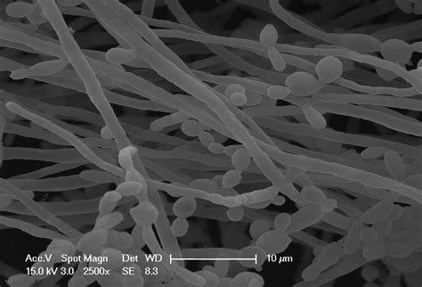 Candidiasis Microscope Pathogenic Attributes Of Non Candida Albicans