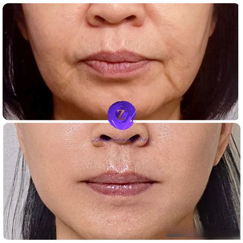 Art Of Transformation Cosmetic Surgery Results