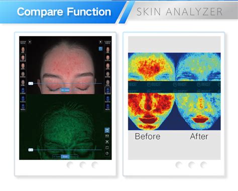 Meicet China Full Face Scan Dermatoscope Intelligent Skin Analyzer