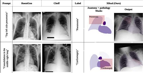 논문 리뷰 Xreal Realistic Anatomy And Pathology Aware X Ray Generation
