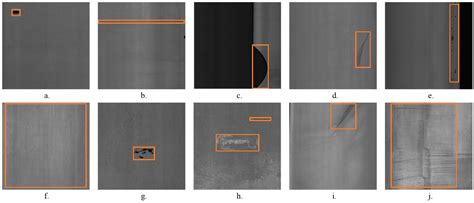 Multiscale Local And Global Feature Fusion For The Detection Of Steel Surface Defects