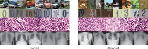 New Ai Approach Can Spot Anomalies In Medical Images With Better Accuracy