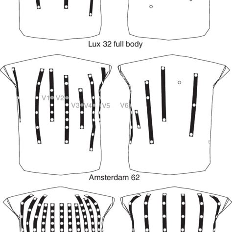 Three Example Electrode Arrays Are Shown In An Anterior Left And Download Scientific Diagram