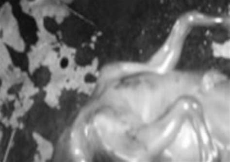 閲覧注意ナイジェリアの女性が 信じられないようなもの を出産 ポッカキットポッカキット