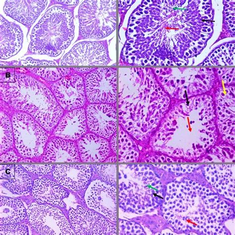 Section Of Testis Showing A Normal Control Group With Normal