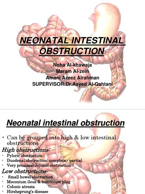 Neonatal Intestinal Obstruction Overview Pdf Pancreas