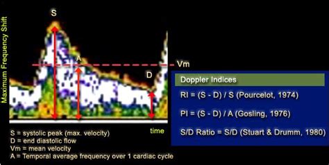 Ultrasound Doppler Ri Pi Sd Ratio