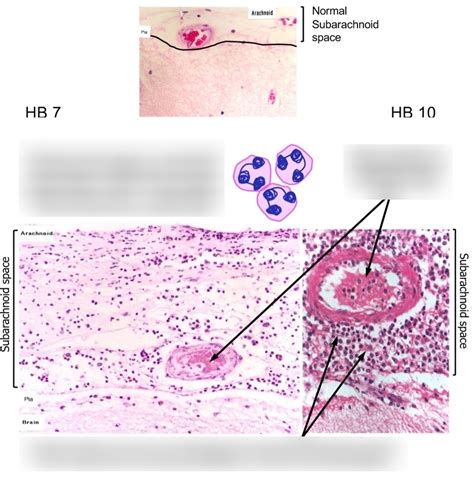 Diagram Of Subarachnoid Space Tute 1 5 Quizlet