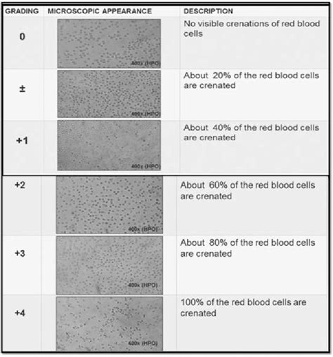Figure 1 From Cold Acid Elution Elu Kit Ii Semantic Scholar