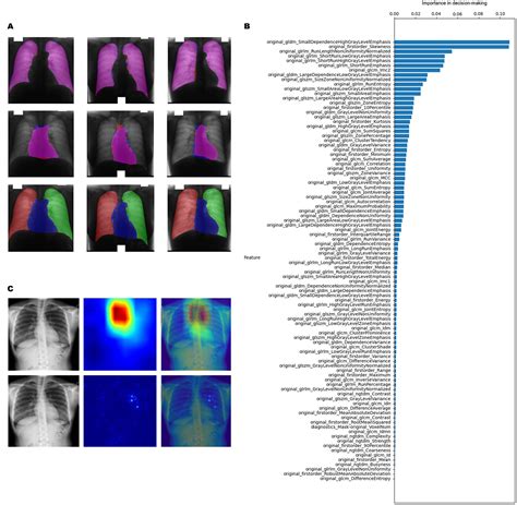Machine Learning Enhanced X Ray Based Radiomics In The Identification