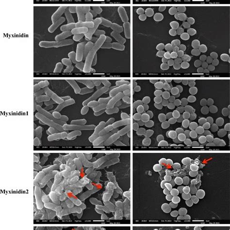 Outer Membrane Permeability Outer Membrane Permeabilization Induced By