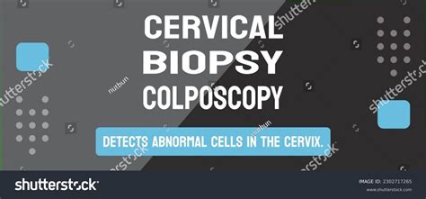 Cervical Biopsy Colposcopy Diagnostic Procedures Cervical Stock Vector