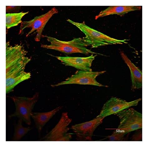Confocal Fluorescence Microscopy Of The Cytoskeleton Demonstrating The Download Scientific