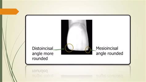 Maxillary Central Incisor Oral Anatomy Pptx