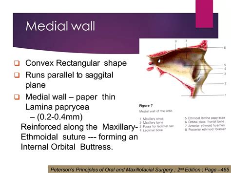 Orbital Fracture And Management Ppt