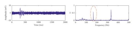Denoising Results In The Time Frequency Domain A Original Signal