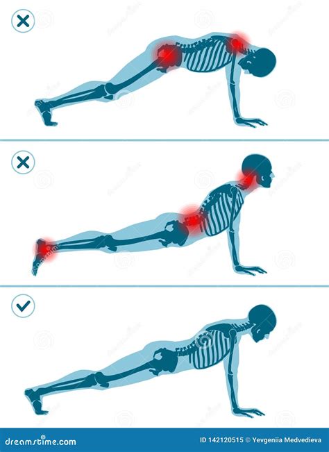 Wrong And Correct Plank Pose Right And Wrong Execution Technique Of