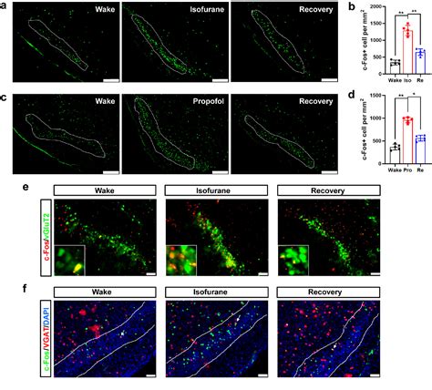 Figure 1 From Glutamatergic Neurons Of Piriform Cortex Delay Induction Of Inhalational General