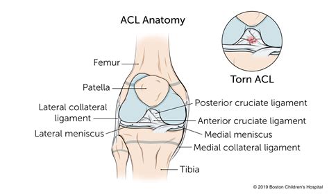 ACL Cedera Horor Untuk Atlet Ini Pengertian Dan Cara Penyembuhannya