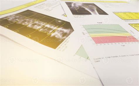 Close Up Bone Density Report 15763277 Stock Photo At Vecteezy