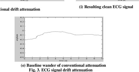 Figure 1 From Intelligent Ecg Signal Noise Removal Using Psonn Semantic Scholar