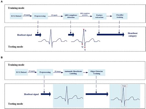 electrocardiogram training