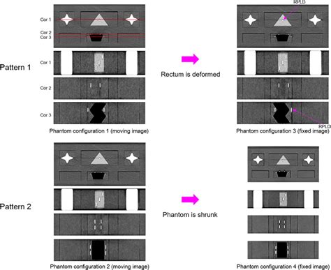 Overview Of Configuration Combination For Each Of The Two Deformable Download Scientific