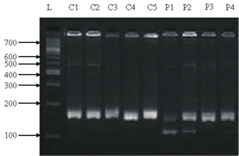 Shows 6 Tae Page Of Nfkb Gene Which Does Not Shows Any Significant Download Scientific