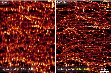 Deep Self Learning Enables Volumetric Microscopy With 3d Isotropic