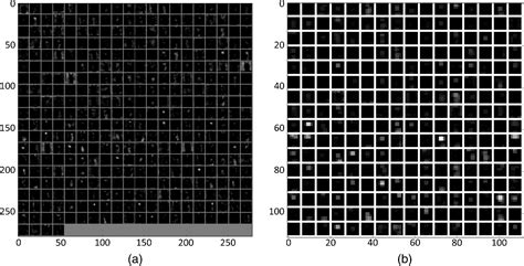 Psnet Prostate Segmentation On Mri Based On A Convolutional Neural Network
