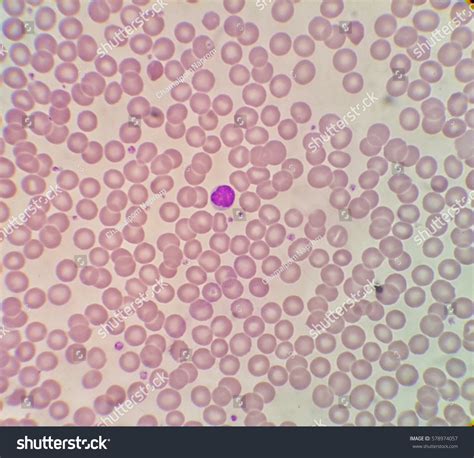 Blood Smear Under Microscope Present Lymphocyte Foto Stock 578974057