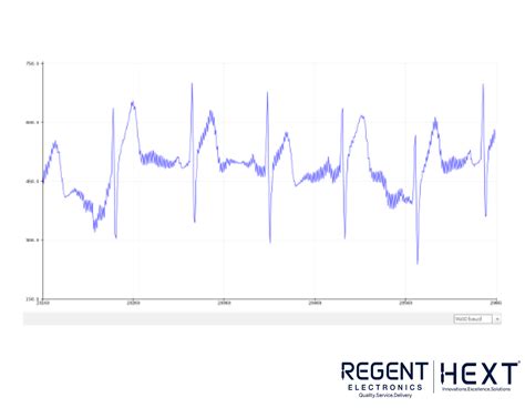 Ad8232 Heart Rate Monitor A Detailed Guide With Arduino Interfacing Regent Electronics