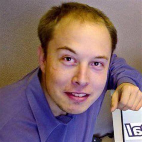 Elon Musks Hair Transformation From Balding To A Full Head Of Hair