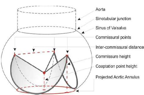 Schematic Of Aortic Annulus Measurements Download Scientific Diagram