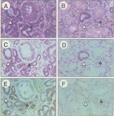 Correlation Of Cellular Ploidy With Tag Expression In The Submandibular