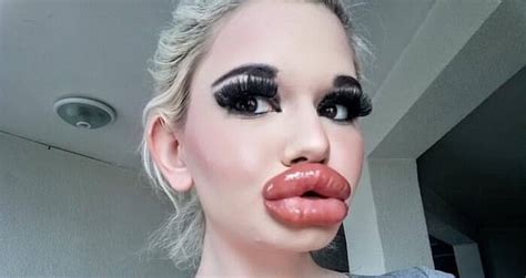 Meet Andrea Ivanova The Woman With The Biggest Lips In The World