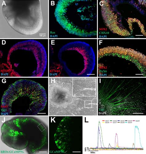 Identification Of Initial Neurogenesis Of Human Neural Retina In Human Download Scientific