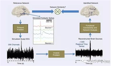 Eeg源分析简介 知乎