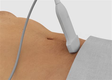 Method Of Bladder Management QSCIS