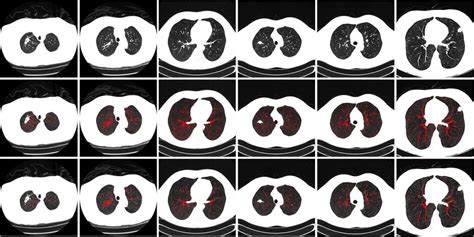 Illustrative Segmentation Results Using The Proposed Method On 6 Download Scientific Diagram