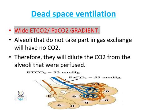 Capnography And Capnometry Etco2 Pptx