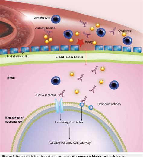 Figure 1 From Neuropsychiatric Systemic Lupus Erythematosus