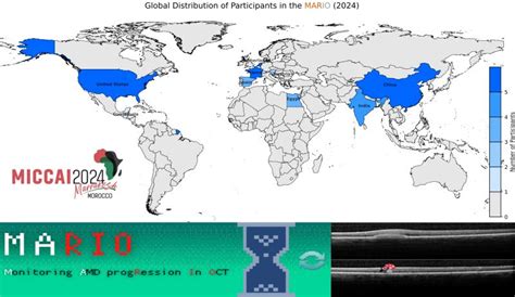 rachid youven zeghlache on linkedin mariochallenge miccai2024 amdresearch