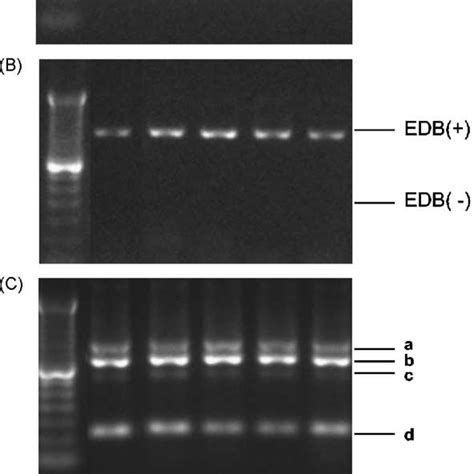 Rt Pcr Analysis Of Alternative Splicing Of Fibronectin Mrna Agarose