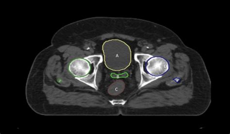 CT Anatomy Diagram Quizlet